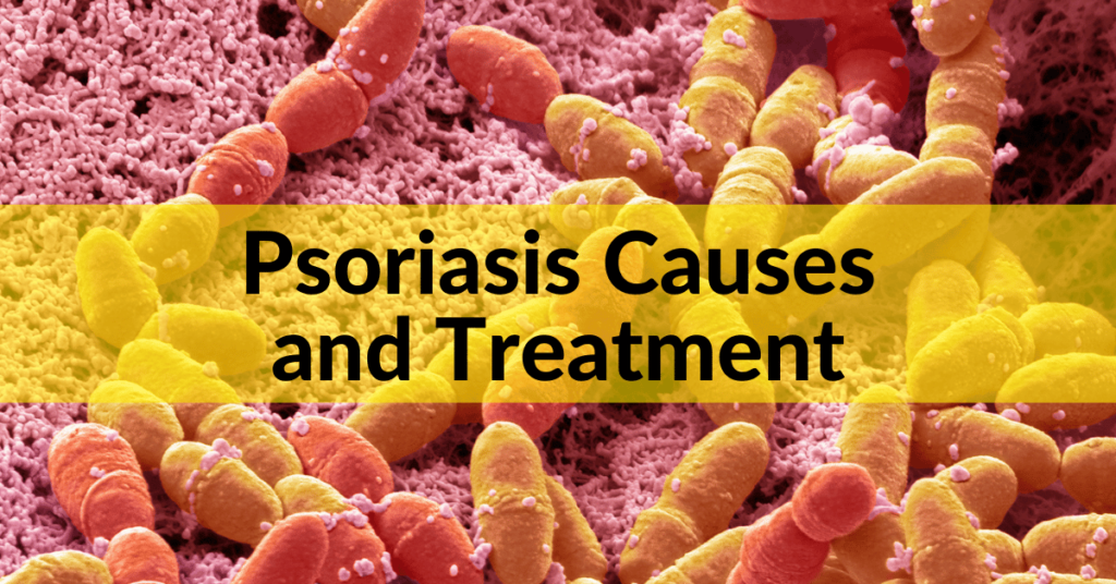 Psoriasis Causes And Treatment The Office Of Dr Brad Shook Dc